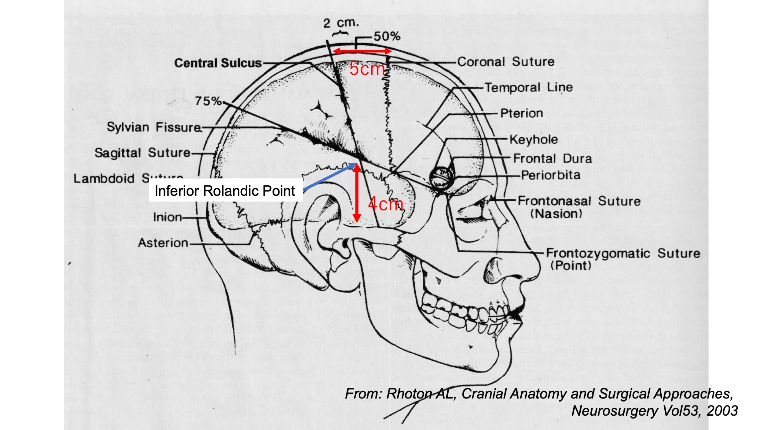 脳を透視する | 日本医科大学脳神経外科