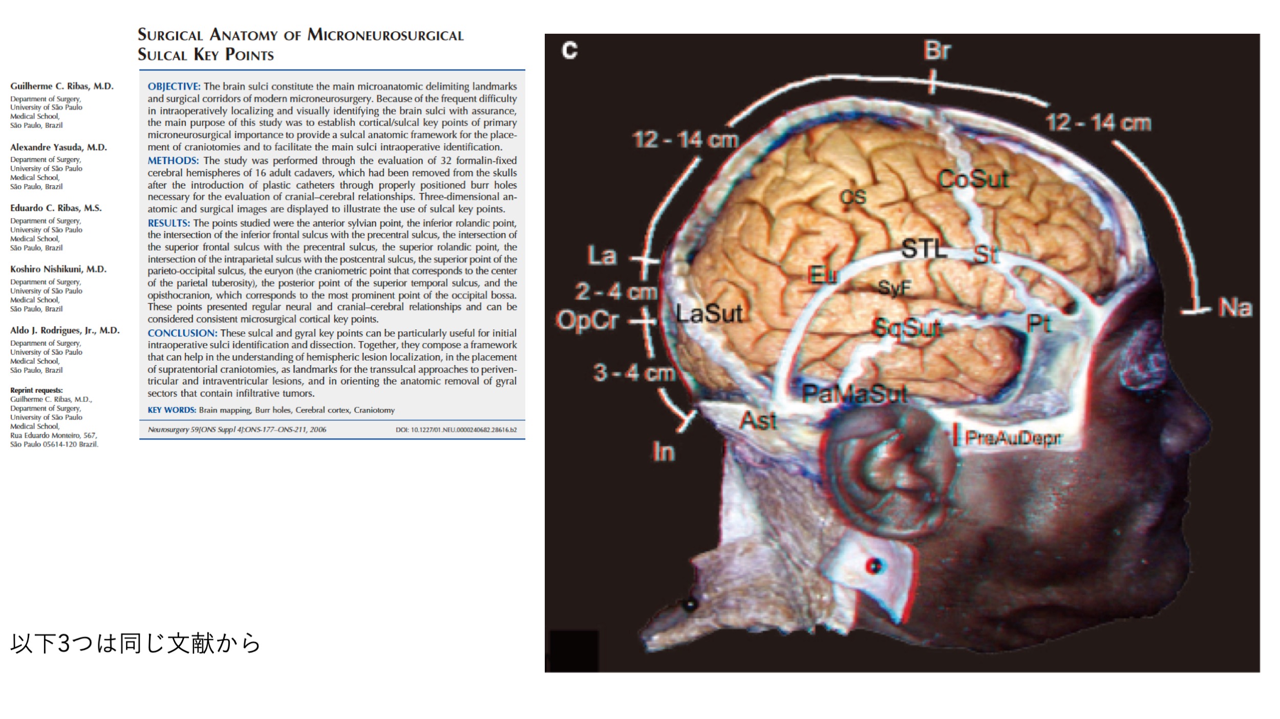 脳を透視する | 日本医科大学脳神経外科