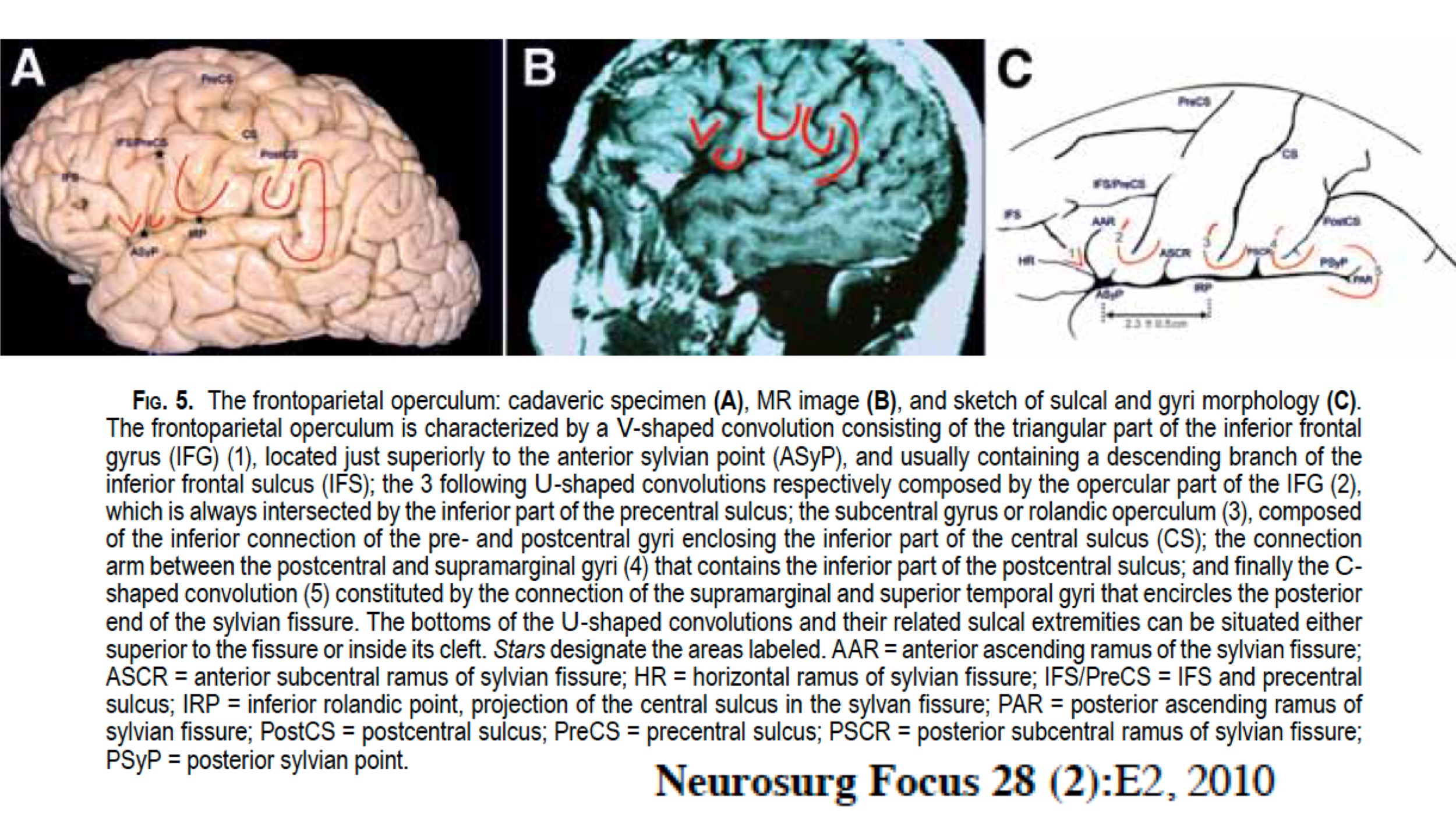 脳を透視する | 日本医科大学脳神経外科