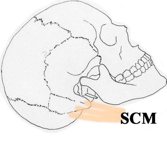 外側後頭下開頭 lateral suboccipital craniotomy | 脳外科医 澤村豊のホームページ